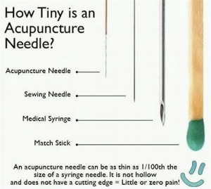 Know all About Acupuncture Needles Size | Legacy Clinic