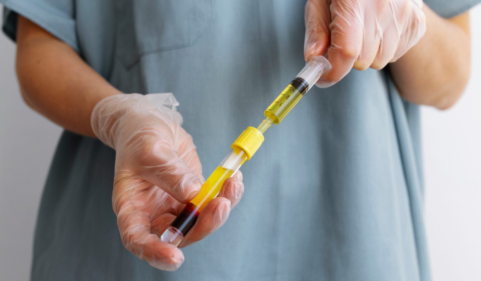 PRP Injections for Back Pain - Legacy Clinic of Chiropractic