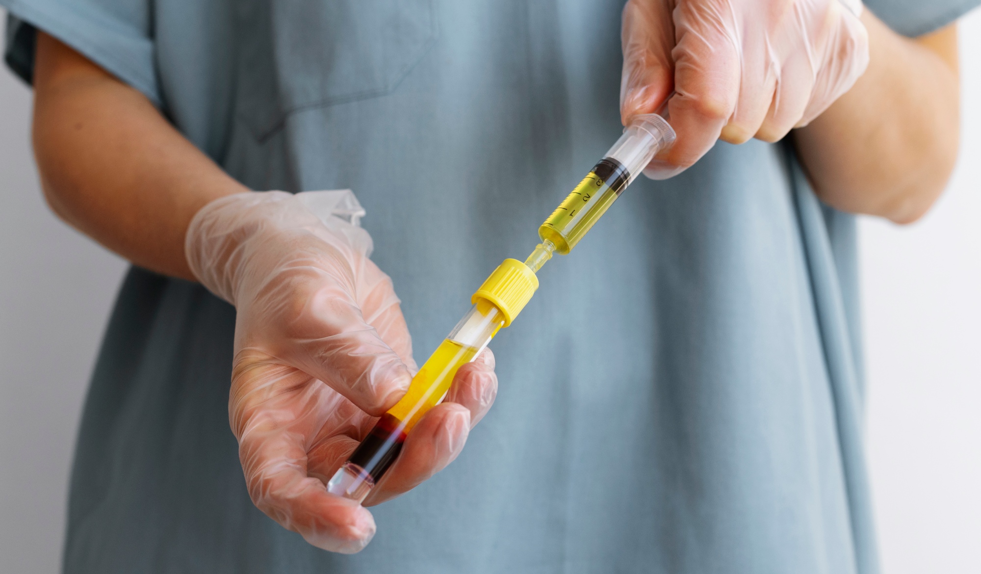 PRP Injections for Back Pain - Legacy Clinic of Chiropractic