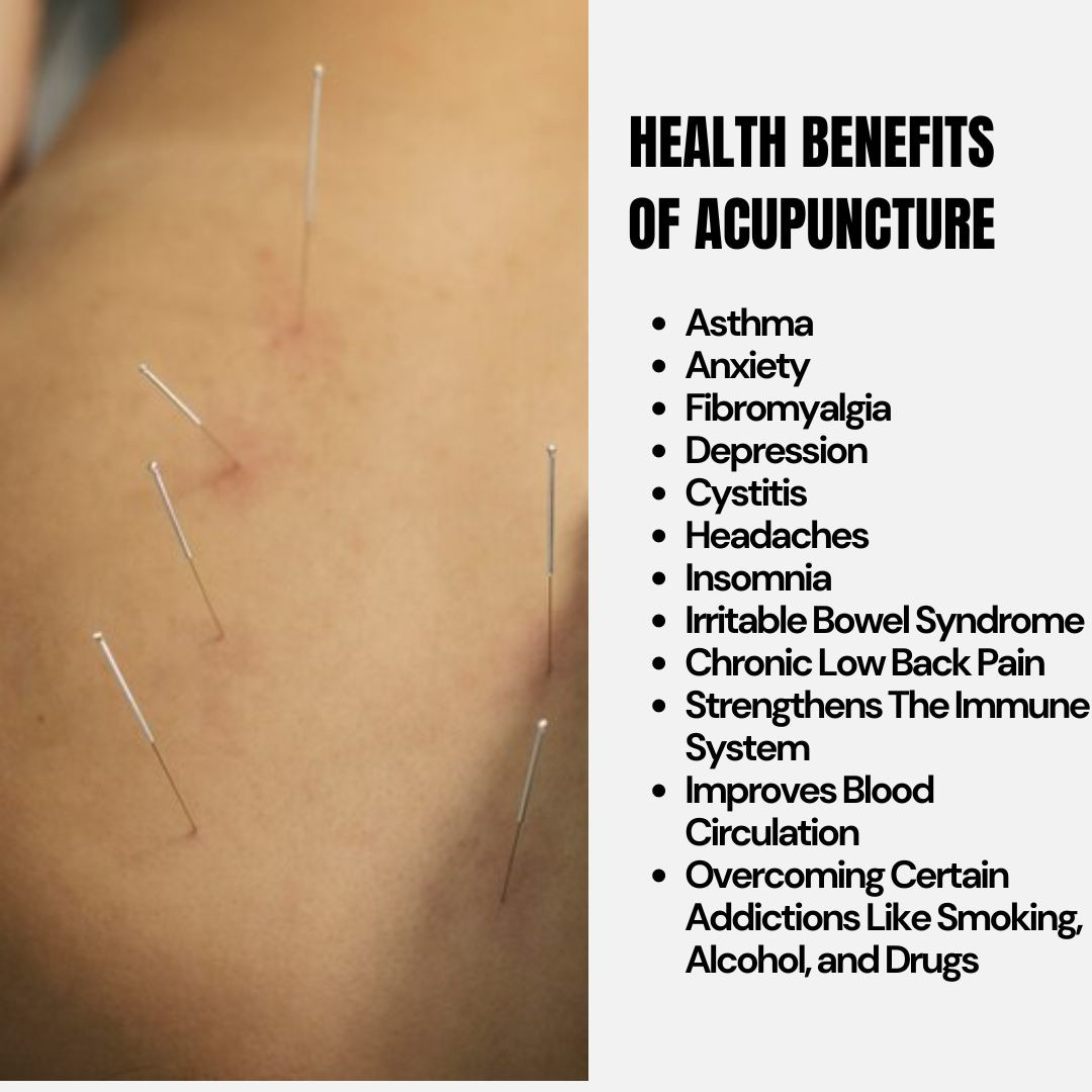 Top Acupuncturist in the Villages - Legacy Clinic Chiropractic